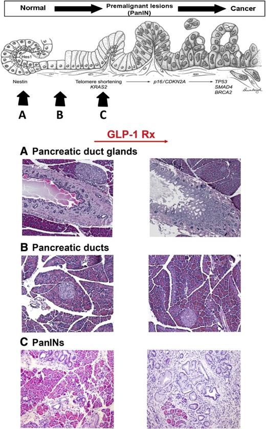 A Critical Analysis of the Clinical Use of Incretin-Based Therapies ...