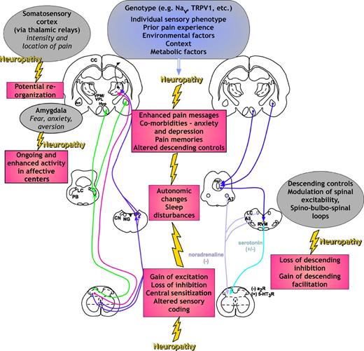Mechanisms and Management of Diabetic Painful Distal Symmetrical ...