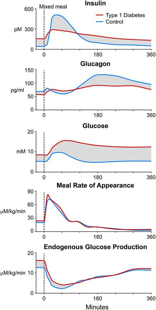 Closed-Loop Artificial Pancreas Systems: Physiological Input to Enhance ...