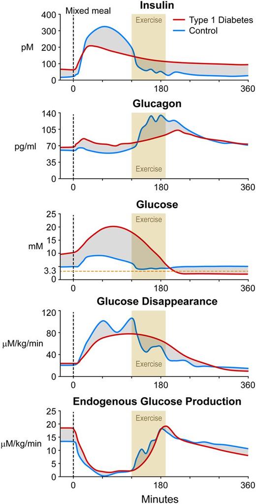Closed-Loop Artificial Pancreas Systems: Physiological Input to Enhance ...