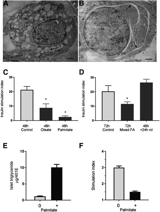 Type 2 Diabetes: The Pathologic Basis of Reversible β-Cell Dysfunction ...