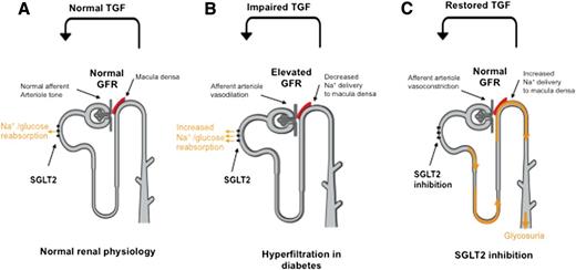 SGLT2 Inhibitors and the Diabetic Kidney | Diabetes Care | American ...