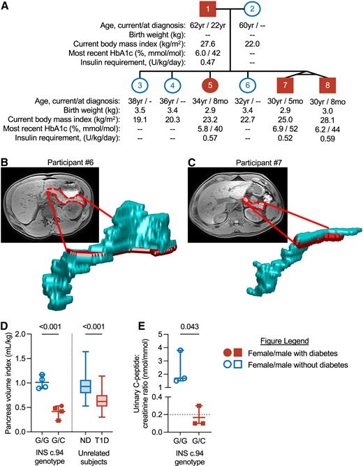 Insulin Deficiency From Insulin Gene Mutation Leads to Smaller Pancreas ...