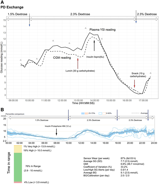 Evaluation of a Fourth-Generation Subcutaneous Real-Time Continuous ...