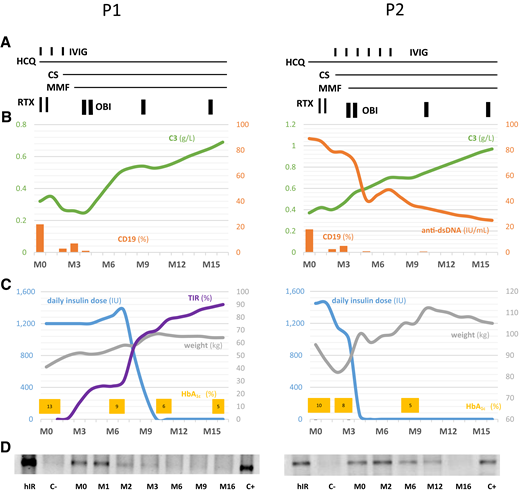 New Therapeutic Perspectives in Type B Insulin Resistance Syndrome ...