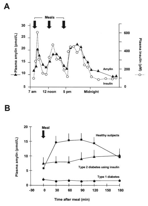 Amylin Replacement With Pramlintide in Type 1 and Type 2 Diabetes: A ...