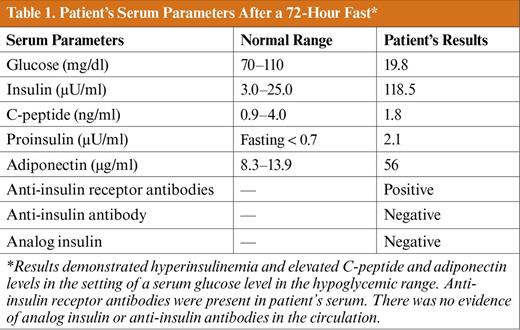 A Case of Persistent Hypoglycemia: When to Think Outside the Box ...