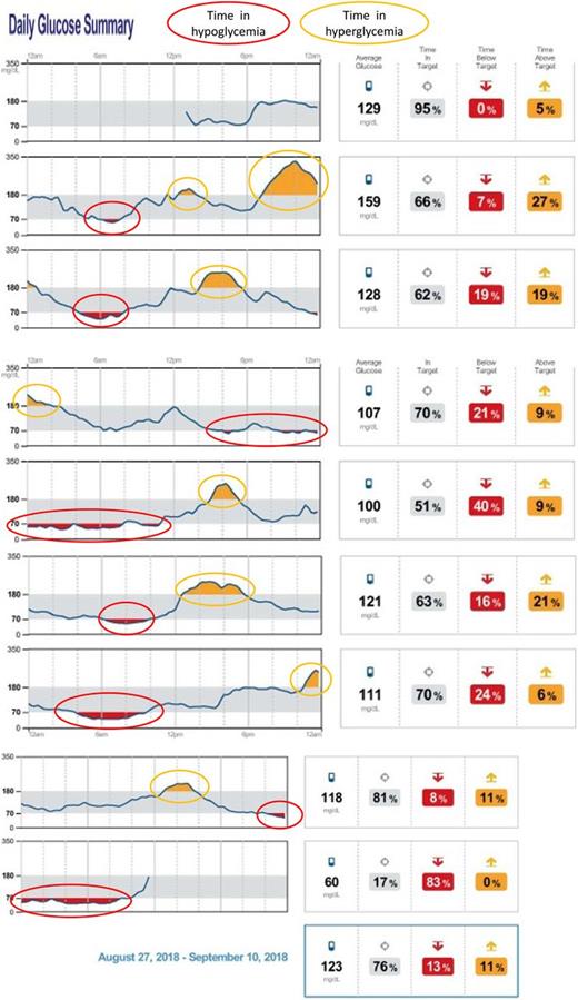 Optimizing Diabetes Care With the Standardized Continuous Glucose ...