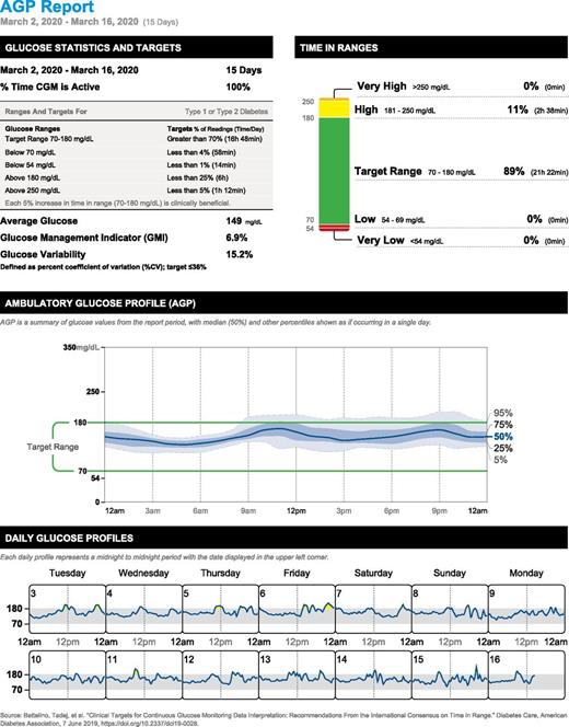 Time in Range: How to Measure It, How to Report It, and Its Practical ...