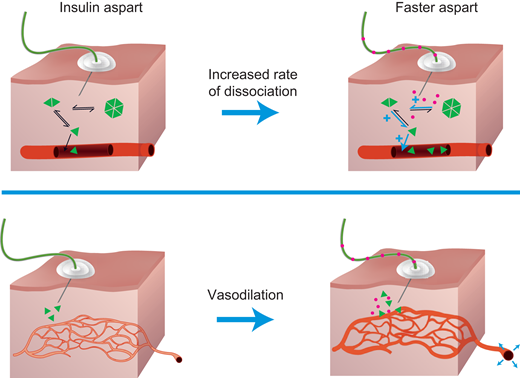 Can Faster Aspart Be Used to Optimize Glycemic Control With Insulin ...
