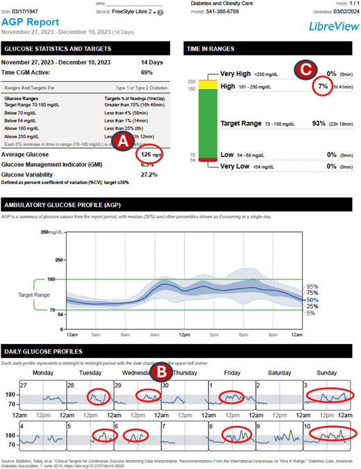 Detection and Intervention: Use of Continuous Glucose Monitoring in the ...