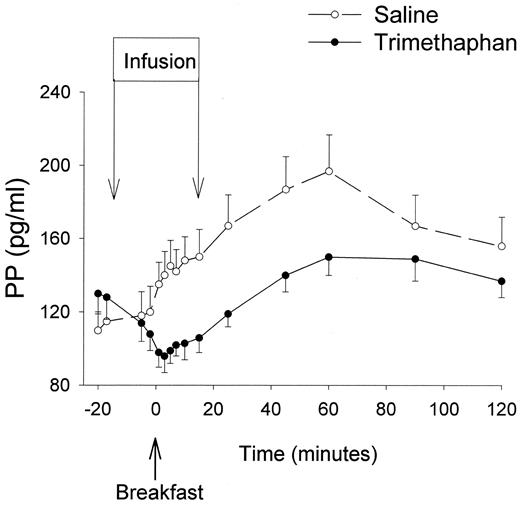 The Cephalic Insulin Response to Meal Ingestion in Humans Is Dependent ...