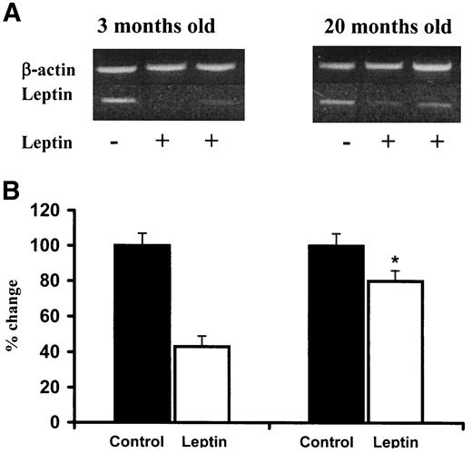 Leptin Resistance During Aging Is Independent of Fat Mass | Diabetes ...