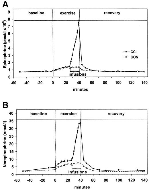 Combined Infusion of Epinephrine and Norepinephrine During Moderate ...