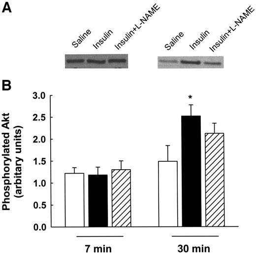 Microvascular Recruitment Is an Early Insulin Effect That Regulates ...