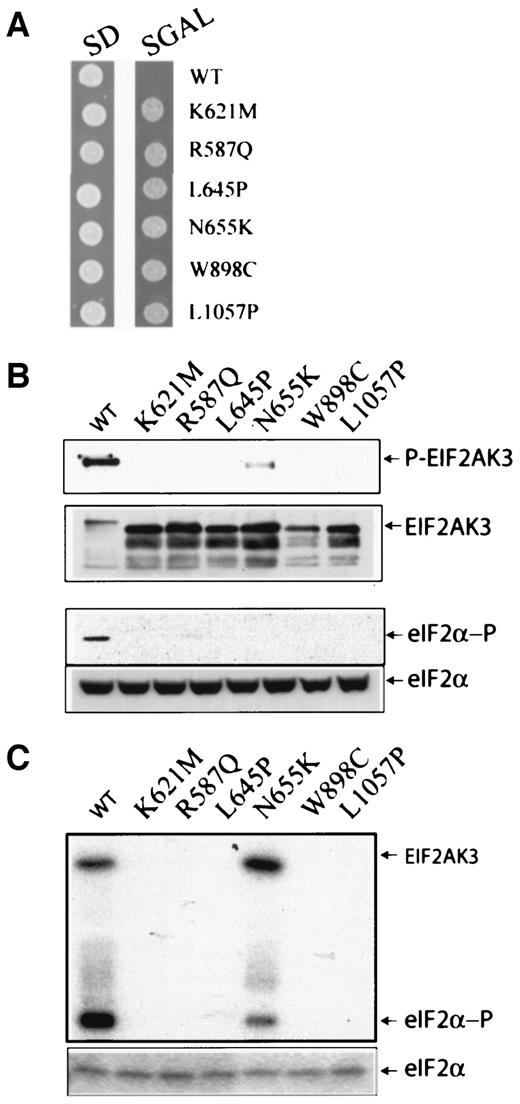 Wolcott-Rallison Syndrome | Diabetes | American Diabetes Association