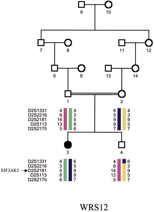 Wolcott-Rallison Syndrome | Diabetes | American Diabetes Association