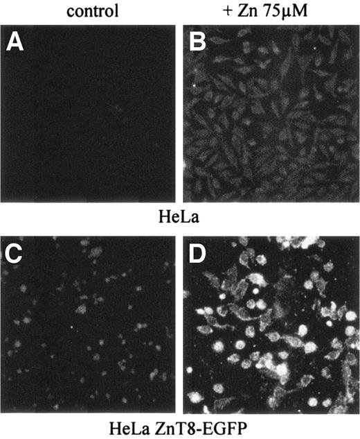 Identification and Cloning of a β-Cell–Specific Zinc Transporter, ZnT-8 ...