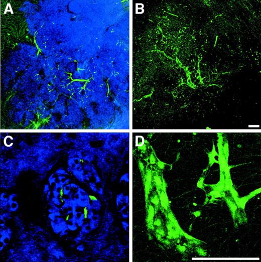 Donor Islet Endothelial Cells Participate in Formation of Functional ...