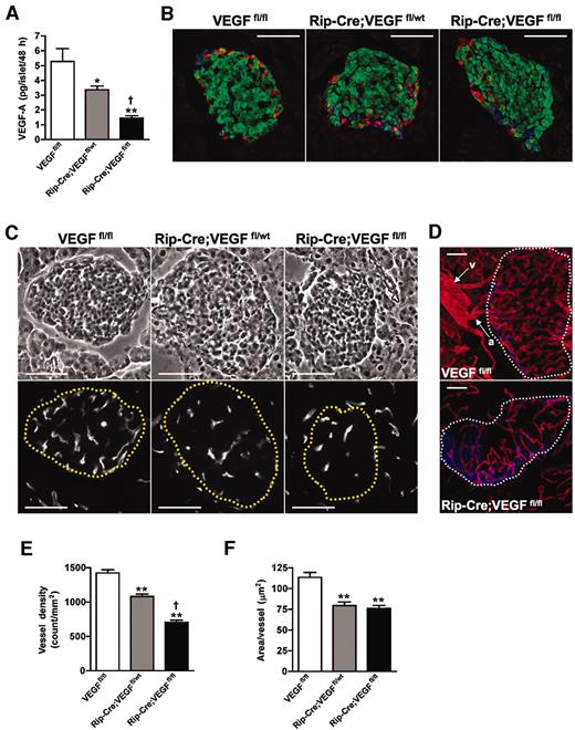 Pancreatic Islet Production of Vascular Endothelial Growth Factor-A Is ...