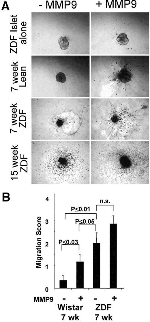 Islet Microvasculature in Islet Hyperplasia and Failure in a Model of ...