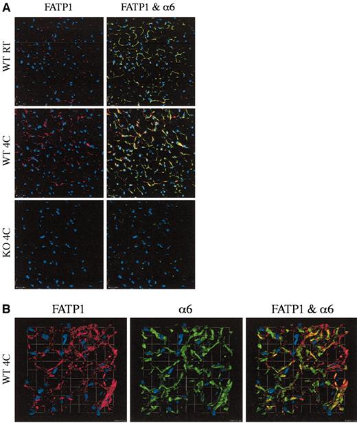 Fatty Acid Transport Protein 1 Is Required for Nonshivering ...