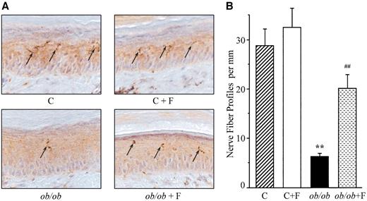 The Leptin-Deficient (ob/ob) Mouse | Diabetes | American Diabetes ...