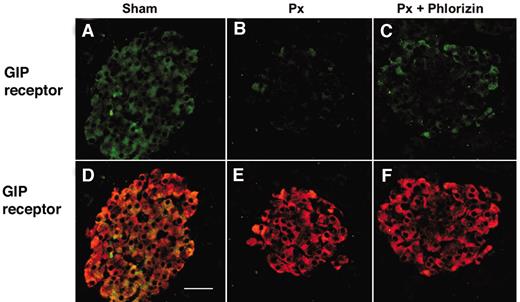 Downregulation of GLP-1 and GIP Receptor Expression by Hyperglycemia ...