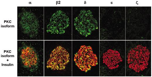 Downregulation of GLP-1 and GIP Receptor Expression by Hyperglycemia ...