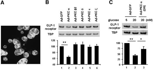 Downregulation of GLP-1 and GIP Receptor Expression by Hyperglycemia ...