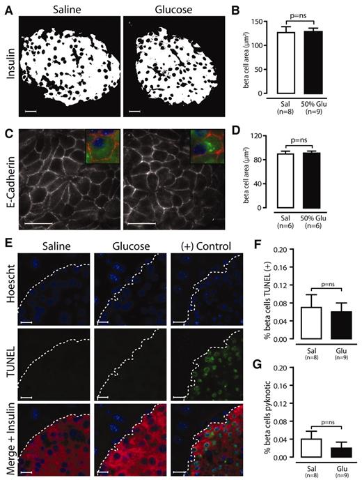 Glucose Infusion in Mice | Diabetes | American Diabetes Association