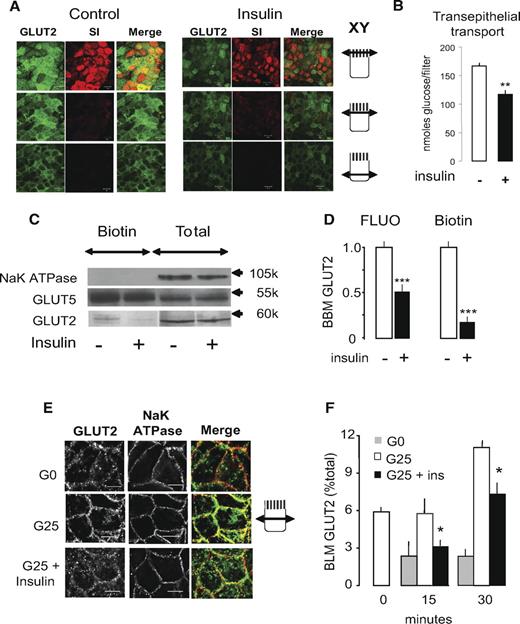 Insulin Internalizes GLUT2 in the Enterocytes of Healthy but Not ...
