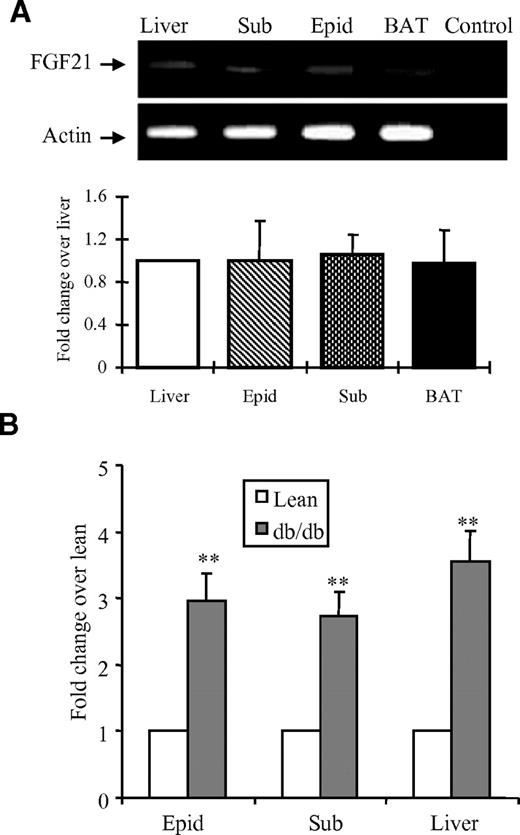 Serum FGF21 Levels Are Increased in Obesity and Are Independently ...