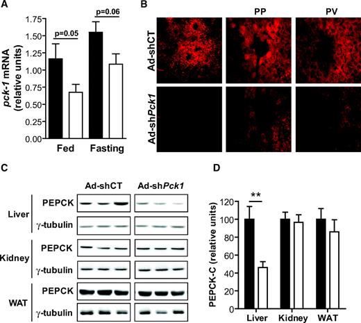 Pck1 Gene Silencing in the Liver Improves Glycemia Control, Insulin ...