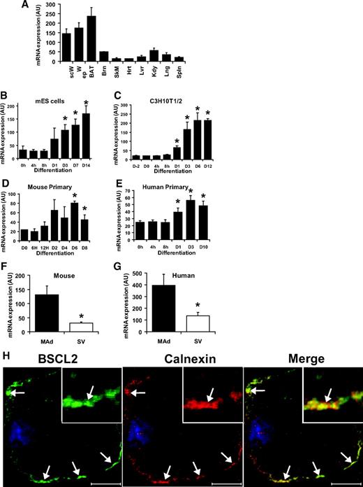 The Human Lipodystrophy Gene BSCL2/Seipin May Be Essential for Normal ...