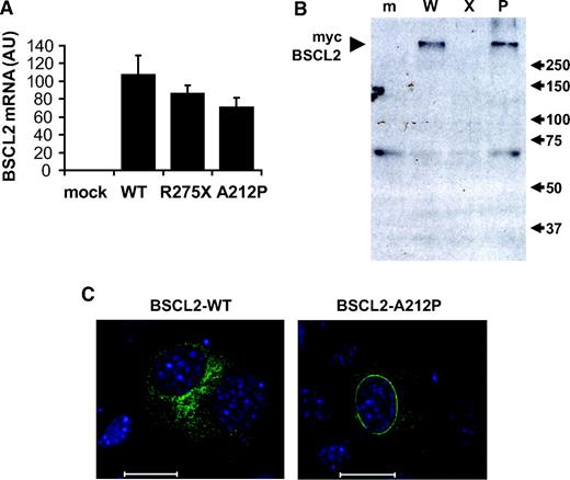The Human Lipodystrophy Gene BSCL2/Seipin May Be Essential for Normal ...