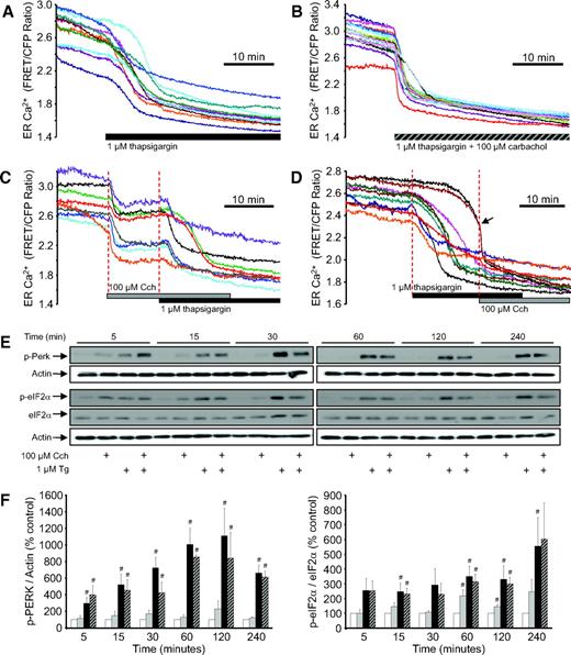 Roles of IP3R and RyR Ca2+ Channels in Endoplasmic Reticulum Stress and ...