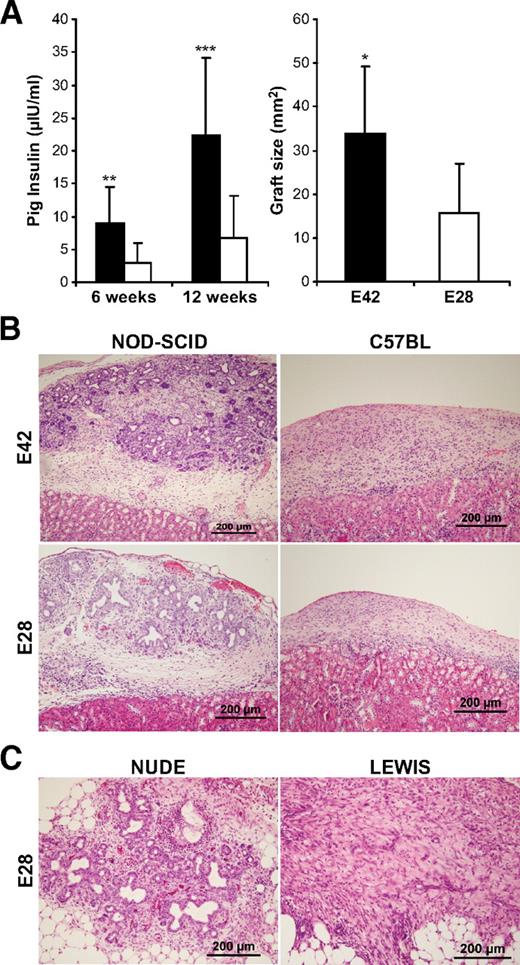 Pig Embryonic Pancreatic Tissue as a Source for Transplantation in ...