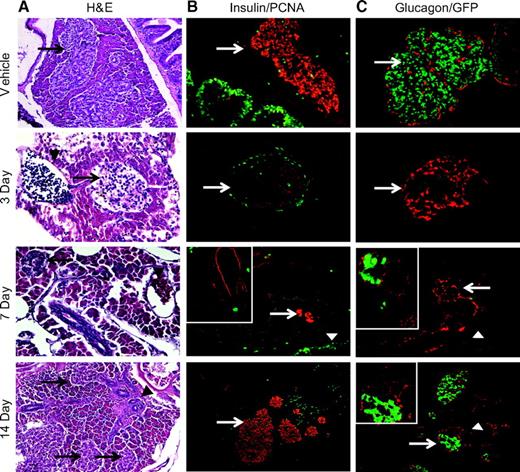 Regeneration of the Pancreas in Adult Zebrafish | Diabetes | American ...