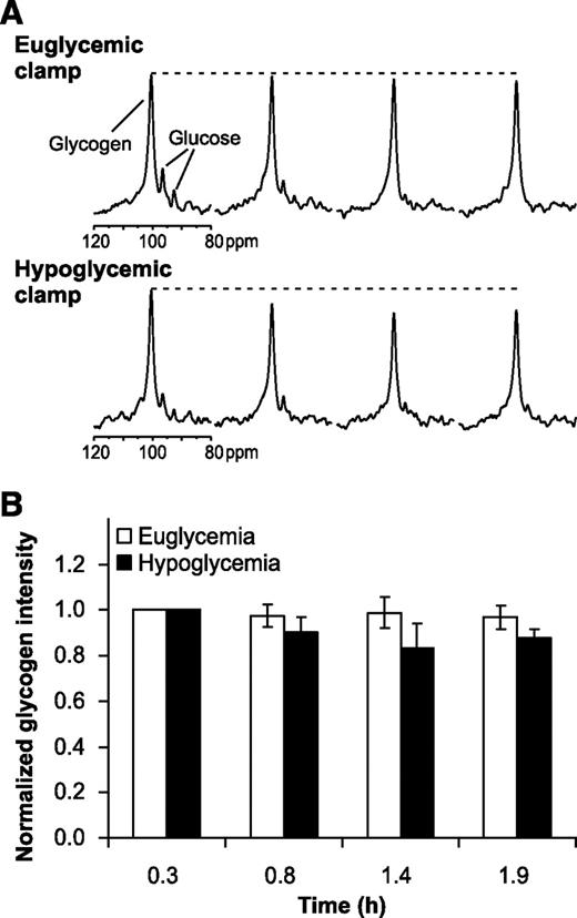 Human Brain Glycogen Metabolism During and After Hypoglycemia ...