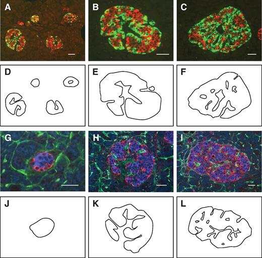 Unique Arrangement of α- and β-Cells in Human Islets of Langerhans ...