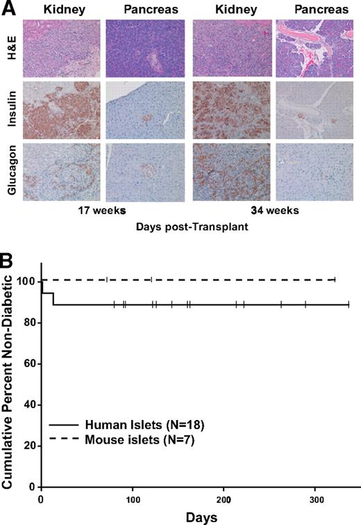 Human Immune System Development and Rejection of Human Islet Allografts ...