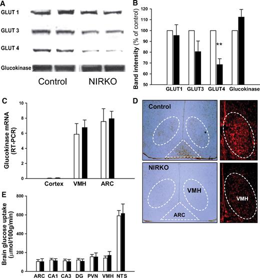 Brain Insulin Action Regulates Hypothalamic Glucose Sensing and the ...