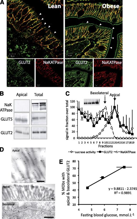 GLUT2 Accumulation in Enterocyte Apical and Intracellular Membranes ...