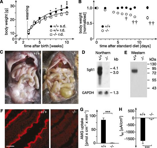 Na+-d-glucose Cotransporter SGLT1 is Pivotal for Intestinal Glucose ...