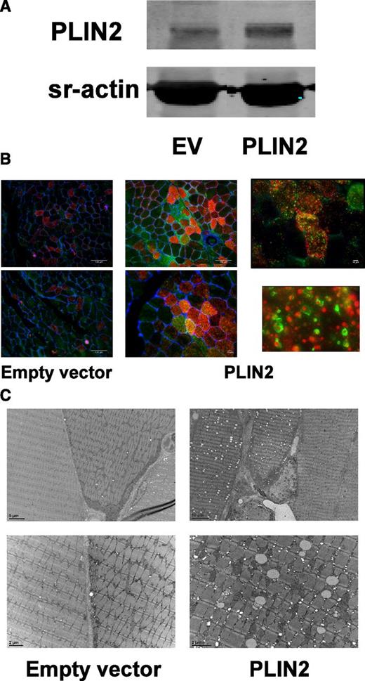 Perilipin 2 Improves Insulin Sensitivity in Skeletal Muscle Despite ...
