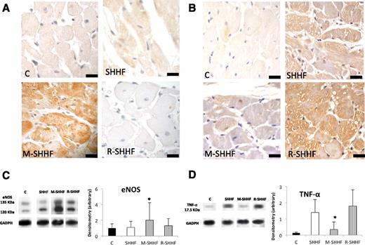 Metformin Prevents the Development of Chronic Heart Failure in the SHHF ...