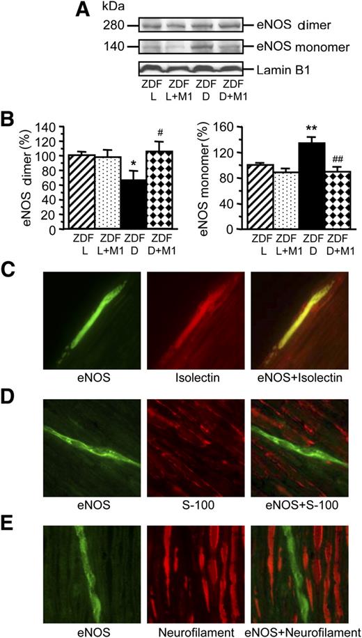 Metanx Alleviates Multiple Manifestations of Peripheral Neuropathy and ...