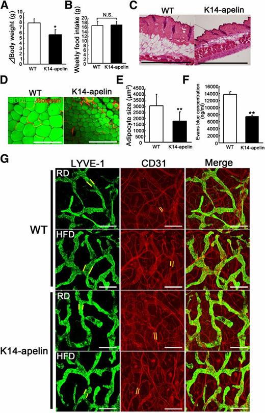 Apelin Inhibits Diet-Induced Obesity by Enhancing Lymphatic and Blood ...