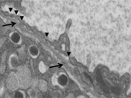 The β-Cell/EC Axis: How Do Islet Cells Talk to Each Other? | Diabetes ...
